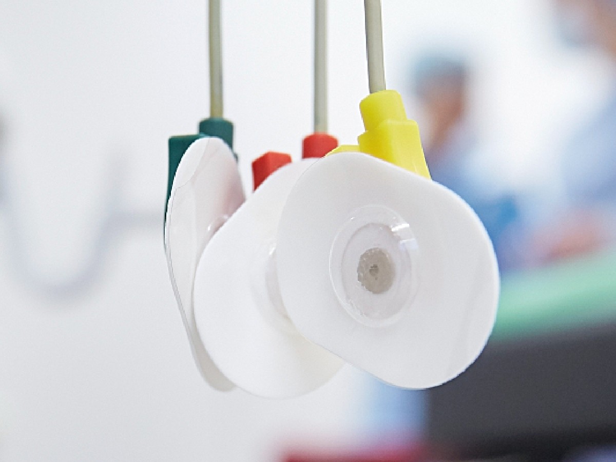 Best Practices for ECG Lead Placement on Women | GE HealthCare (India)